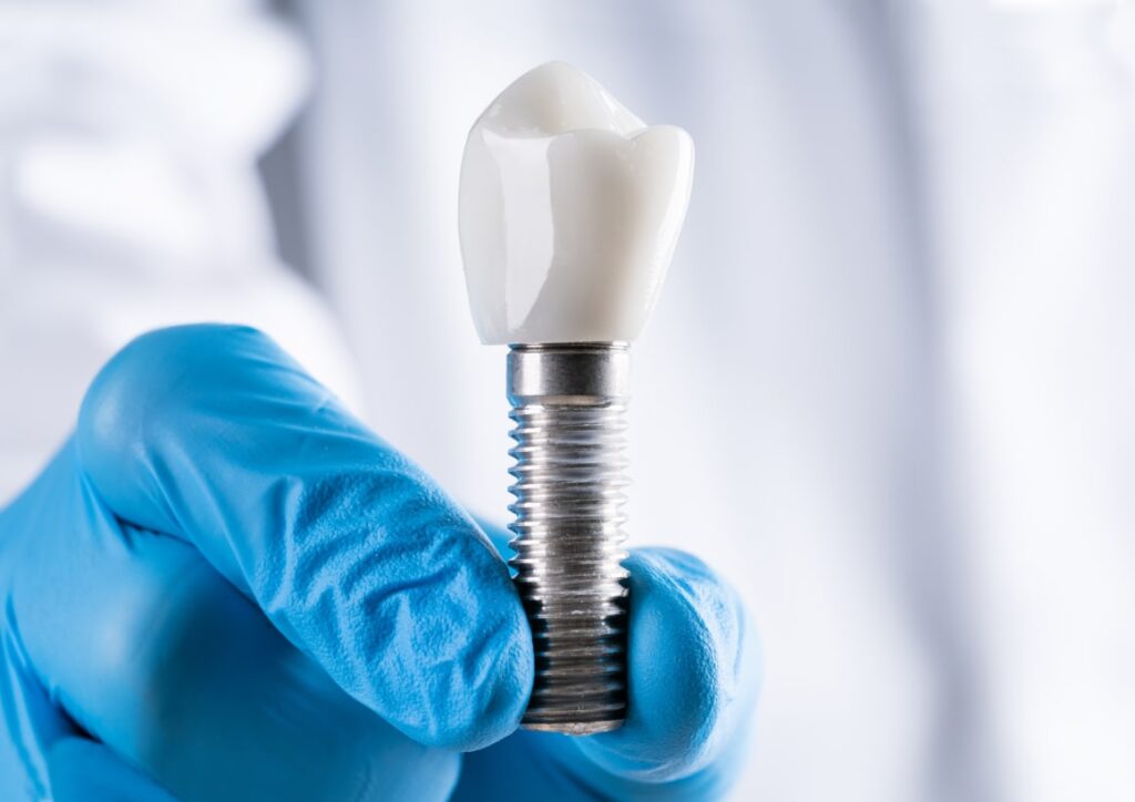 Dental Concepts