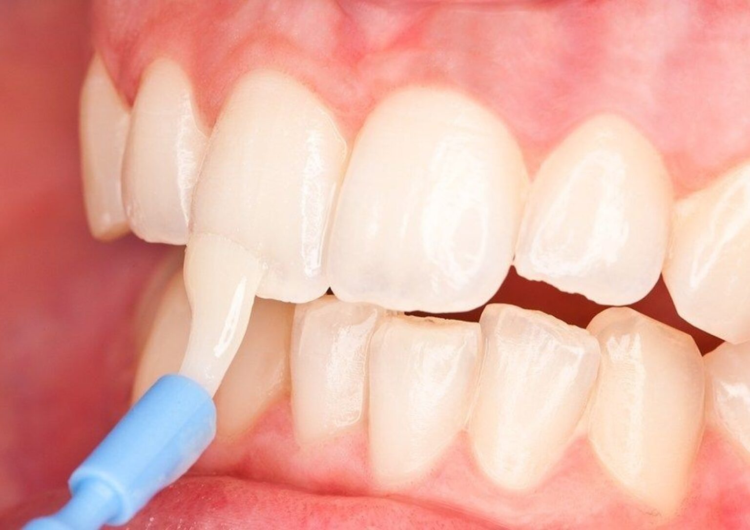 Dental Concepts